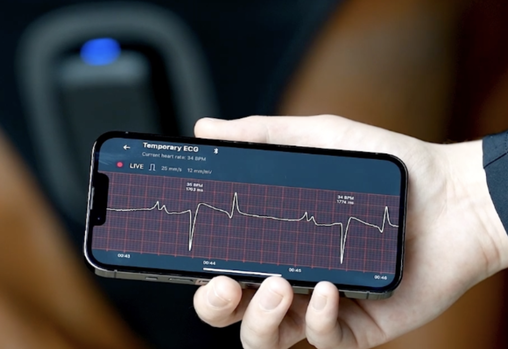 V-PRO – Smart Equine Monitoring | Equimetrics